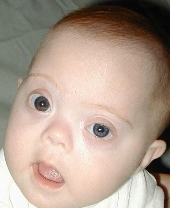 Everything You've Ever Wanted To Know About Heterochromia