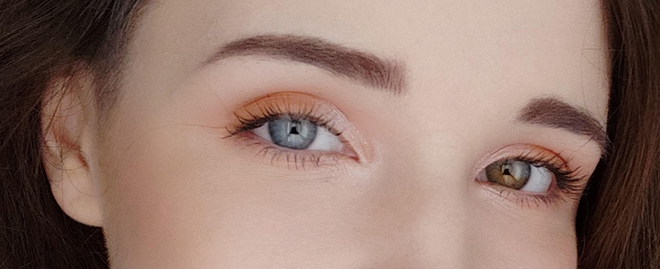 Everything You've Ever Wanted To Know About Heterochromia