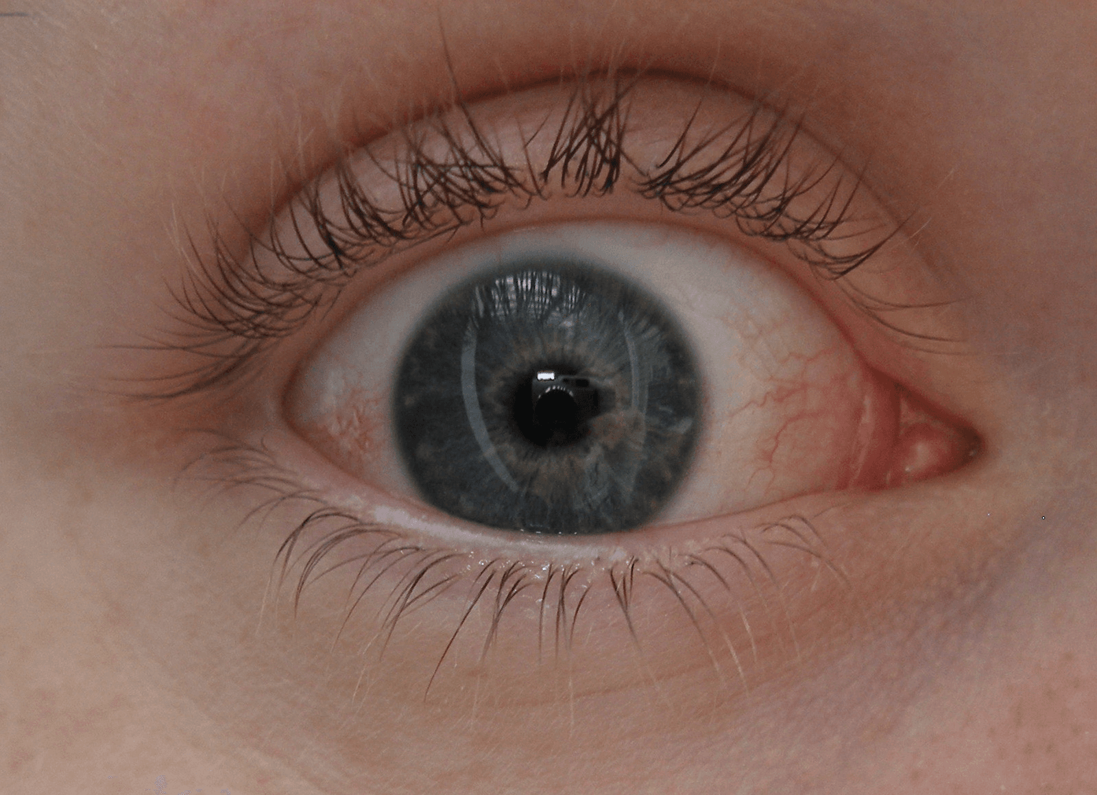 There's Physical Evidence Of Evolution Right On Your Body