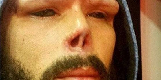 Henry Damon Is So Determined To Look Like The Red Skull, He Tattooed ...