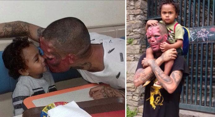 Henry Damon Tattoos Man Chops Off Nose To Look Like Captain America's