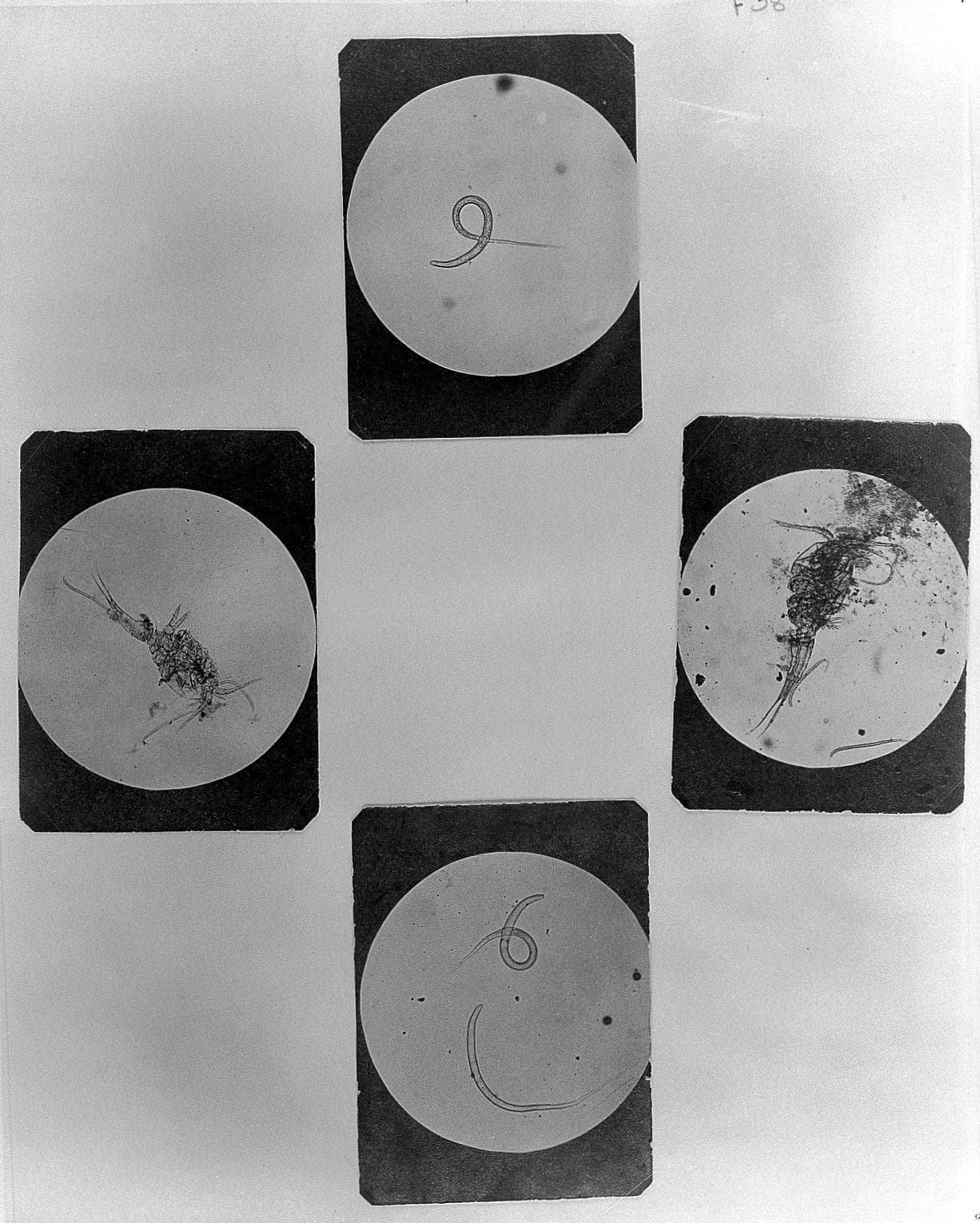 The Unending Life Cycle Of The Guinea Worm Inside The Human Body
