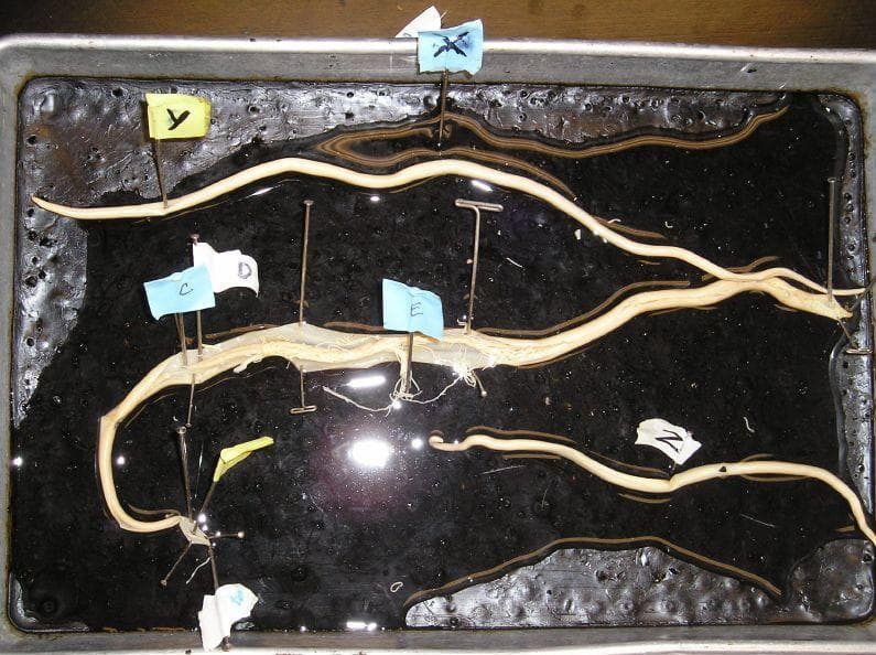 Here Is Everything You Need To Know If You Ever Find Yourself Coughing ...