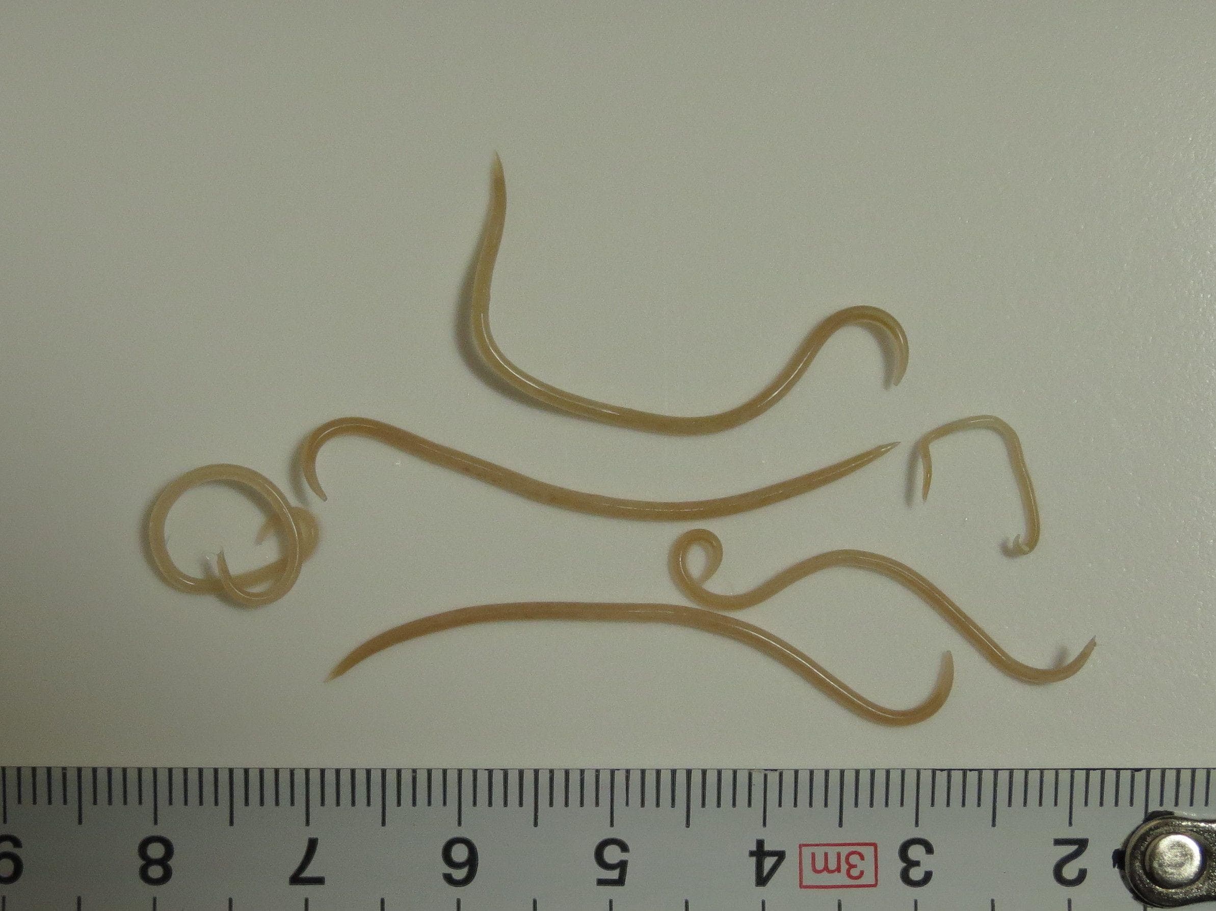 Here Is Everything You Need To Know If You Ever Find Yourself Coughing ...