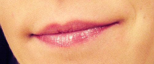 Everything You Need To Know Before Getting Lip Injections
