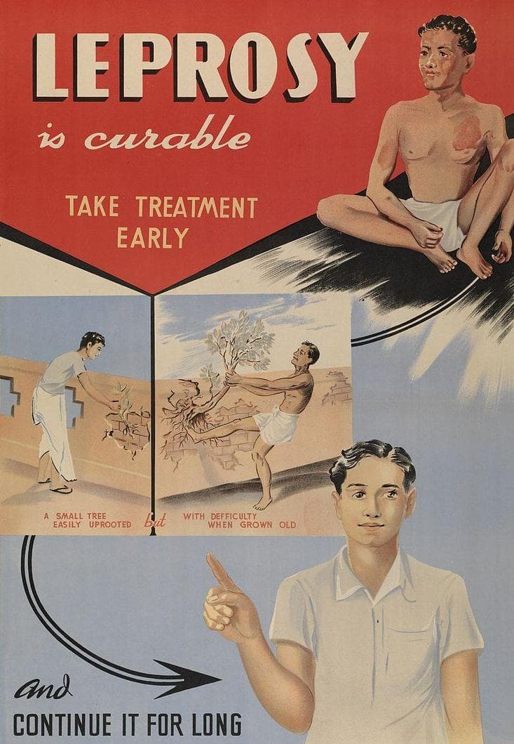 Here Is Everything You (Never) Wanted To Know About Leprosy