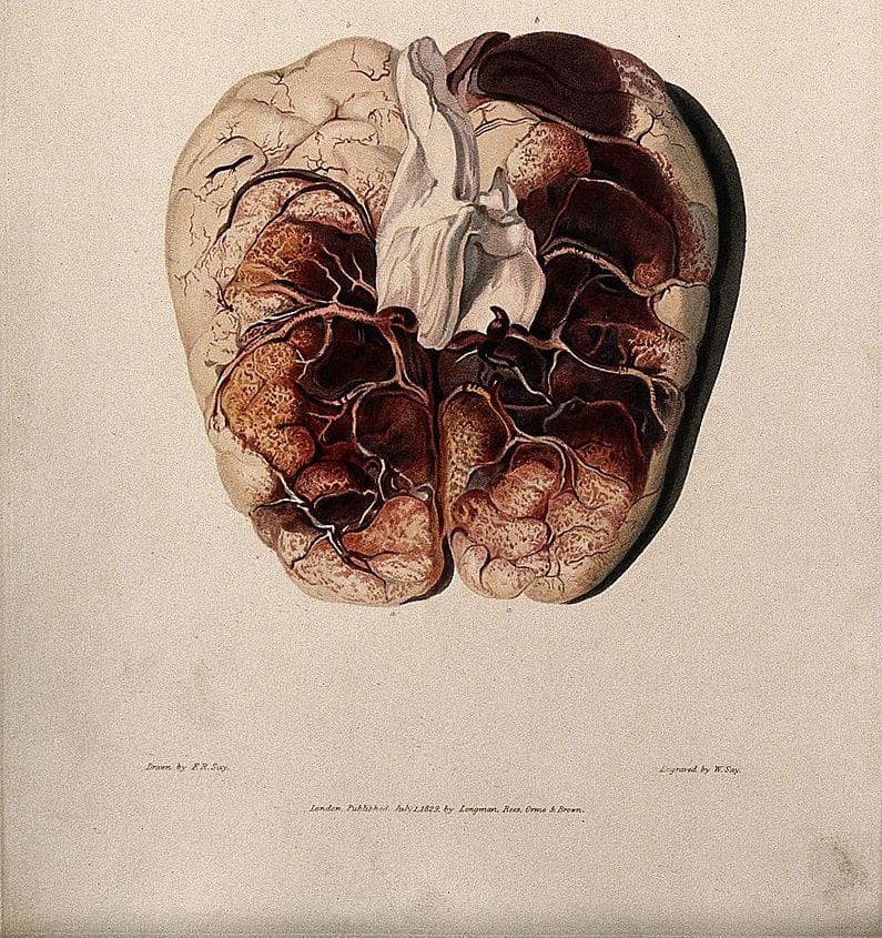“Brain In A Bucket” Is A Creepy New Study That Could Lead To A “Living ...