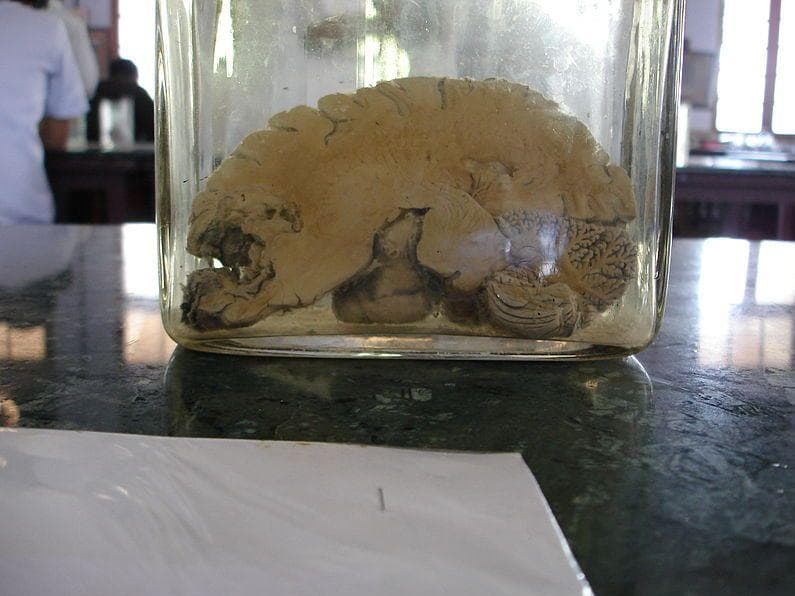 “Brain In A Bucket” Is A Creepy New Study That Could Lead To A “Living ...