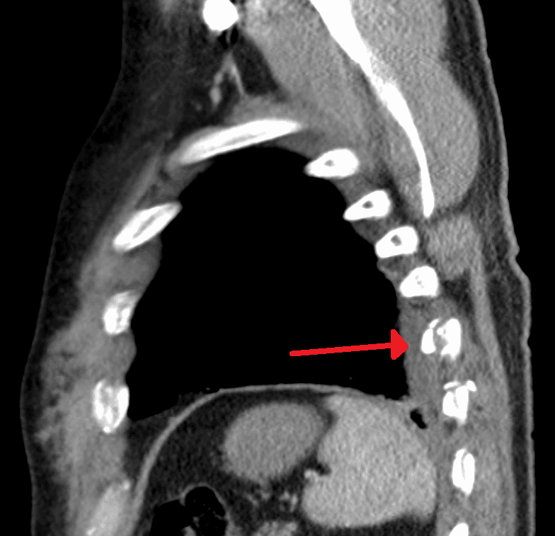 Here Are The 16 Most Painful Injuries Someone Can Experience