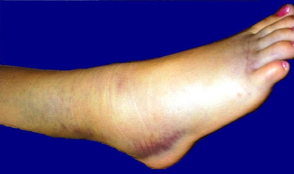 Here Are The 16 Most Painful Injuries Someone Can Experience