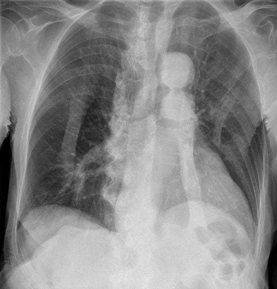 Here Are The 16 Most Painful Injuries Someone Can Experience