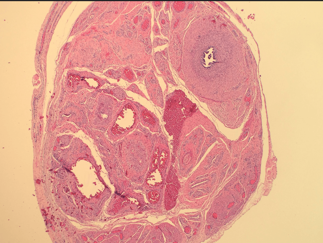 Here Are The 16 Most Painful Injuries Someone Can Experience