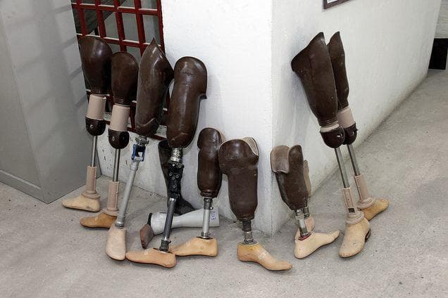 How Xenomelia Is Leading Healthy Individuals To Amputate Their Limbs