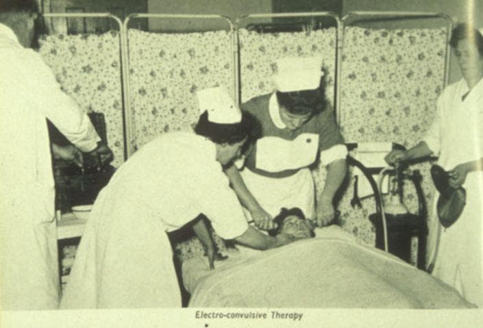 Electroshock Therapy Facts: Why It's Still Being Used Today