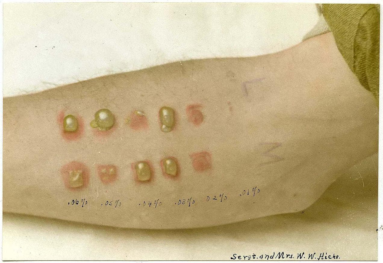 How The US Experimented On Soldiers At Edgewood Arsenal