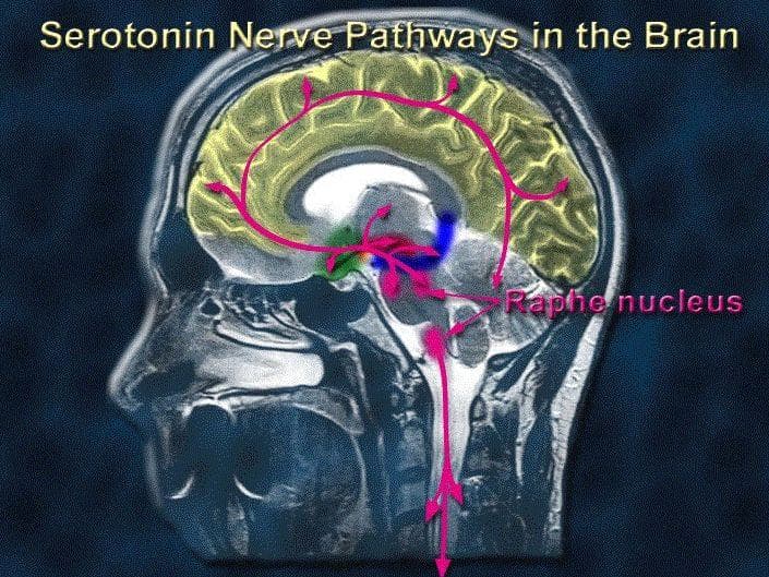LSD Effects On Your Body: What Happens When You're Tripping