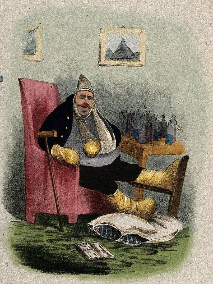 All About Gout, 'The Disease Of Kings'