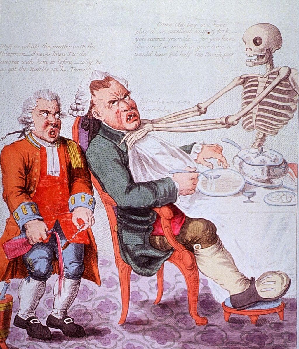 All About Gout, 'The Disease Of Kings'