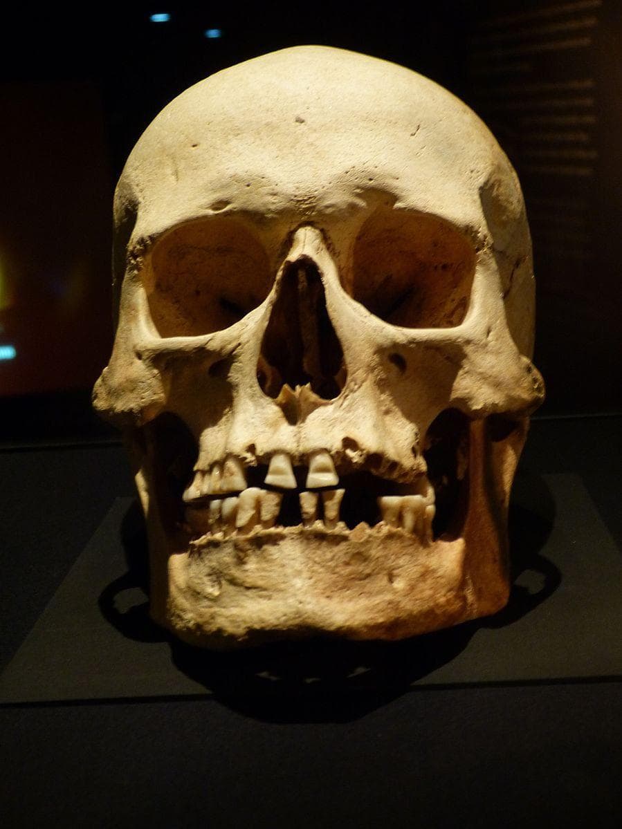 How Teeth Have Indicated Status Throughout History