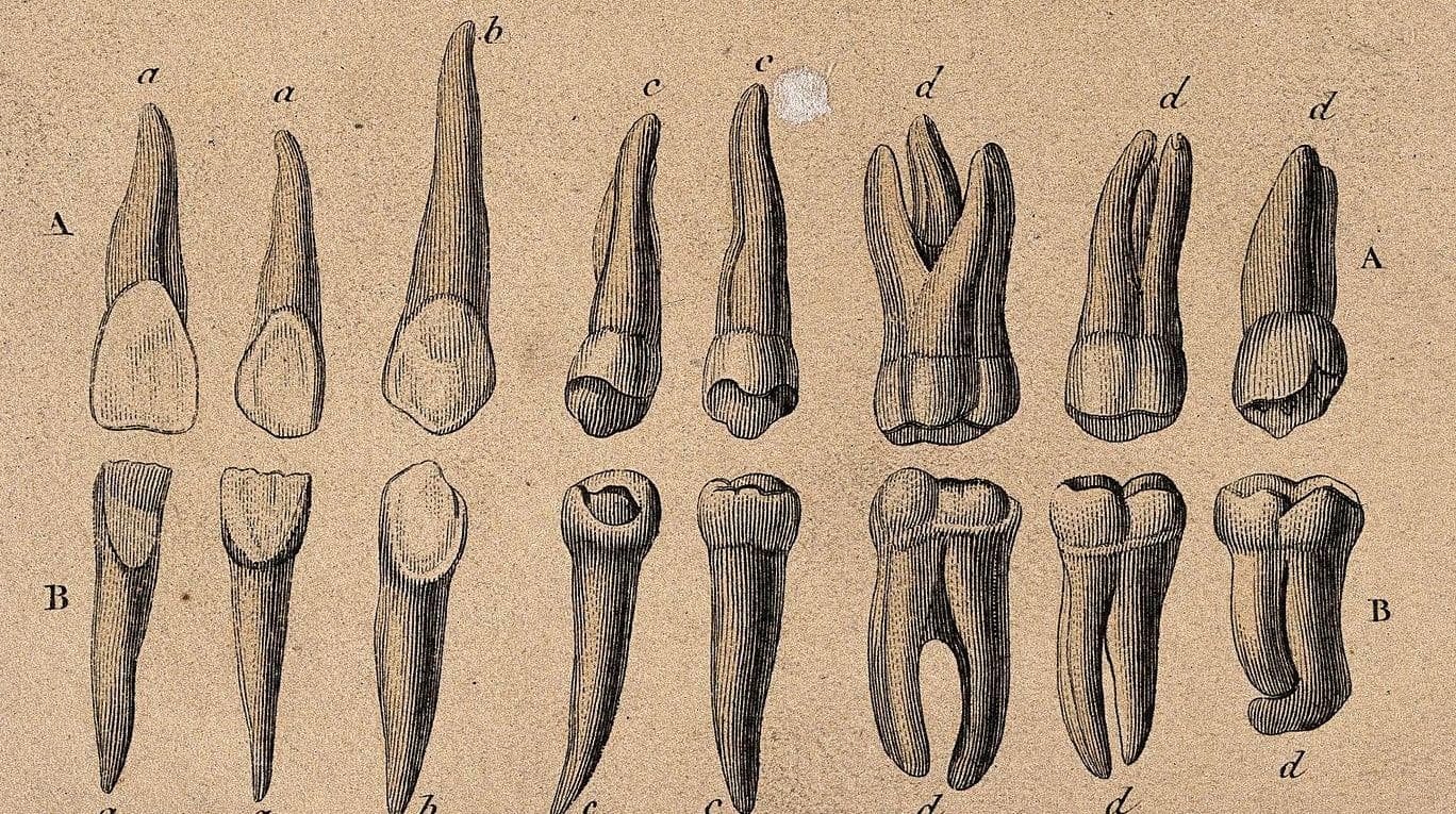 How Teeth Have Indicated Status Throughout History