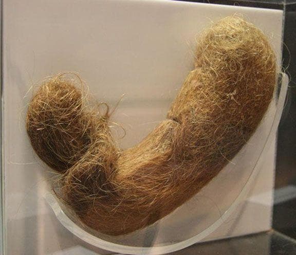 Gruesome Facts About The Natural Museum Of Health And Medicine In Maryland