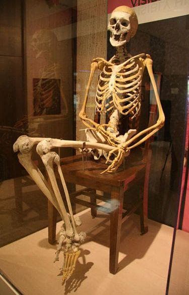 Gruesome Facts About The Natural Museum Of Health And Medicine In Maryland