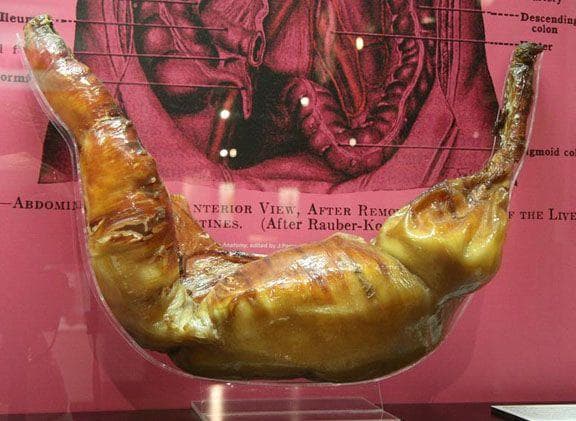 Gruesome Facts About The Natural Museum Of Health And Medicine In Maryland