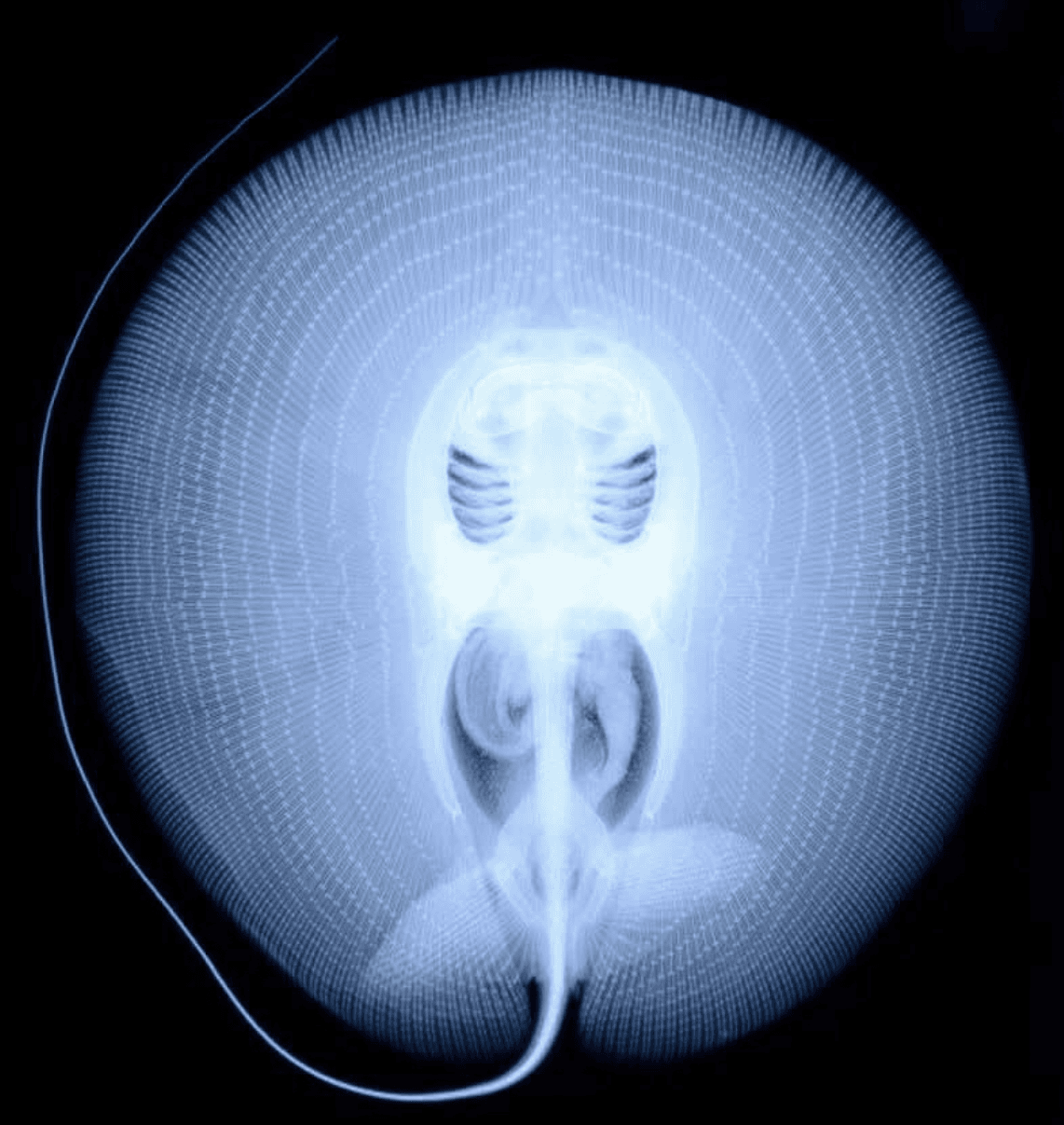 20 Interesting Pictures That Will Make You Say 'Huh'