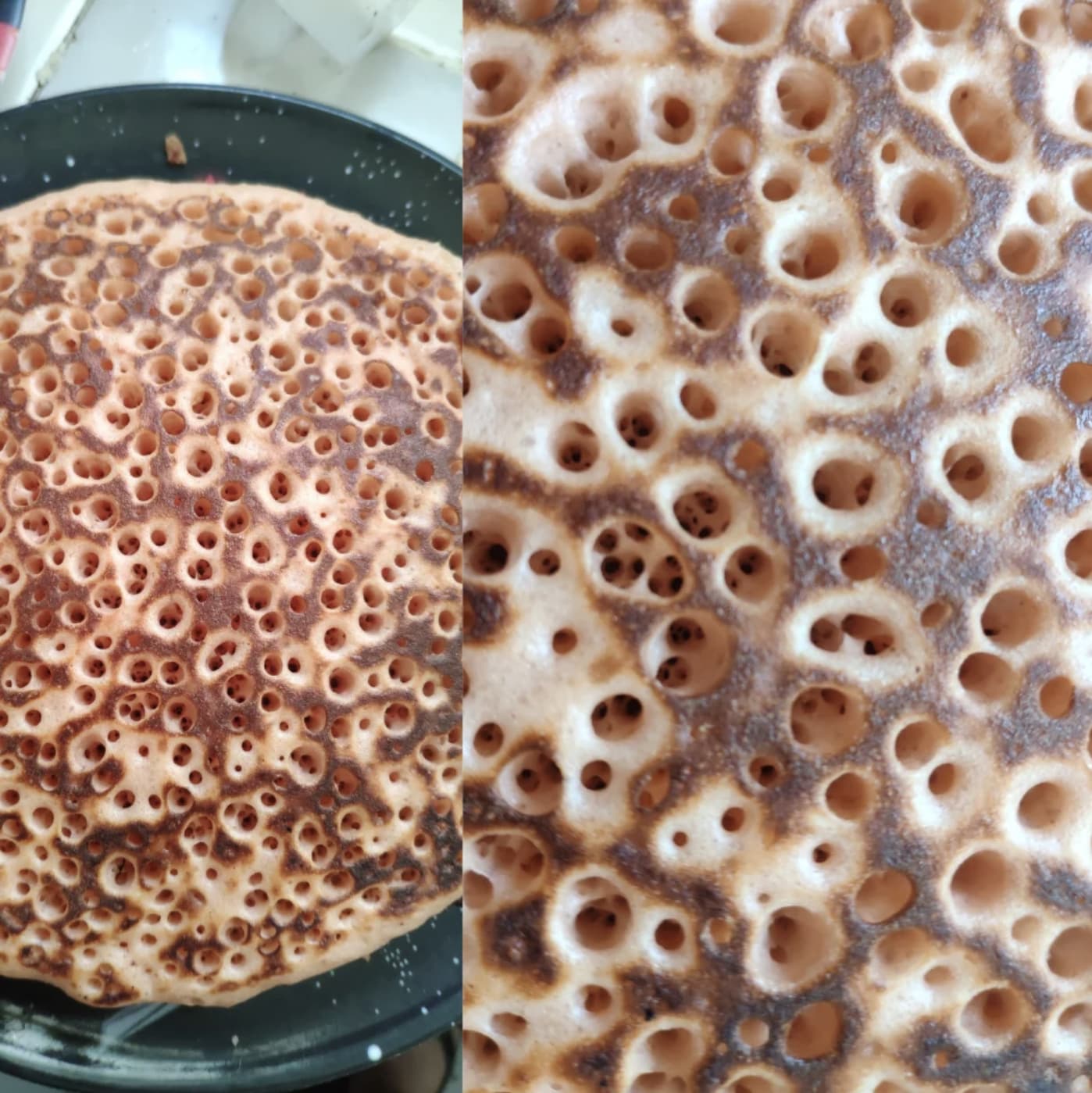 People Share Their Unexpected Trypophobia Moments