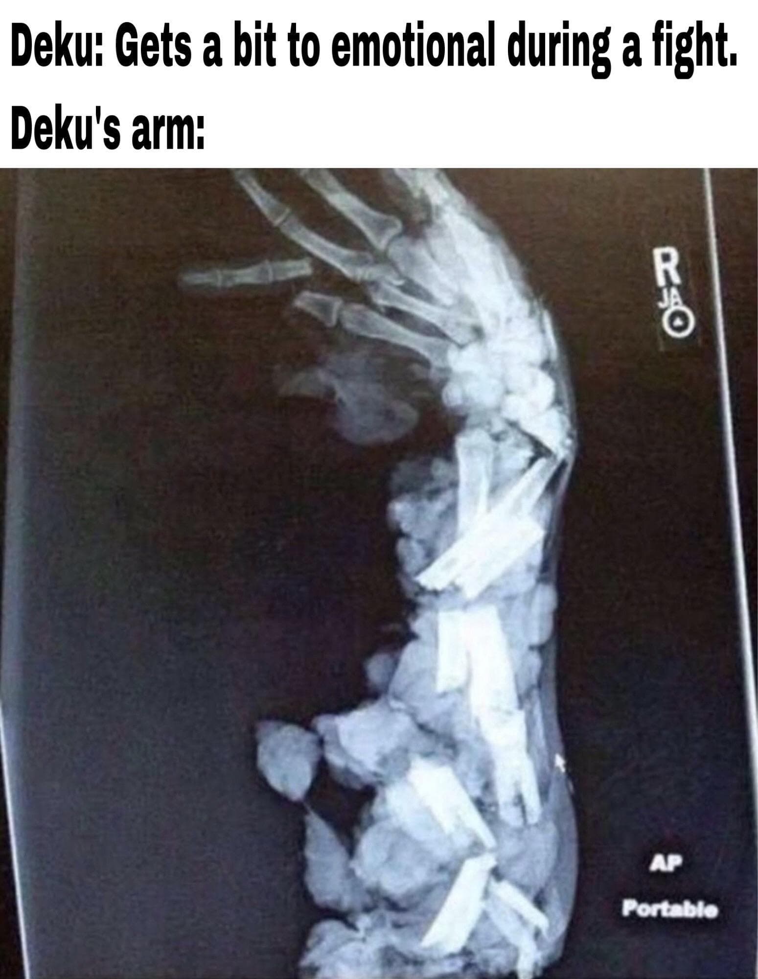 20 Savage 'My Hero Academia' Memes We Feel Guilty For Laughing At