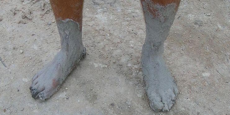 10 Facts About Human Feet That Made Our Toes Curl