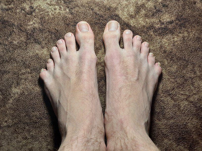 10 Facts About Human Feet That Made Our Toes Curl