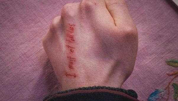 The Most Painful Injuries In 'Harry Potter'