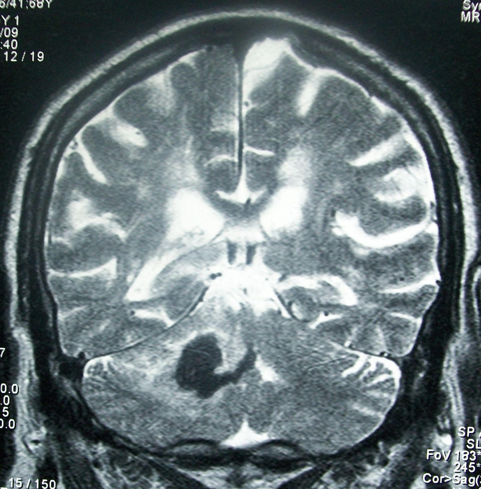 Creepy And Disturbing History Facts That Unsettled Us In 2022