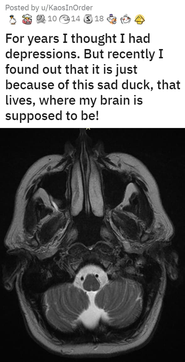 29 Hilarious Reddit Posts That Kept Us Smiling Throughout All Of 2022