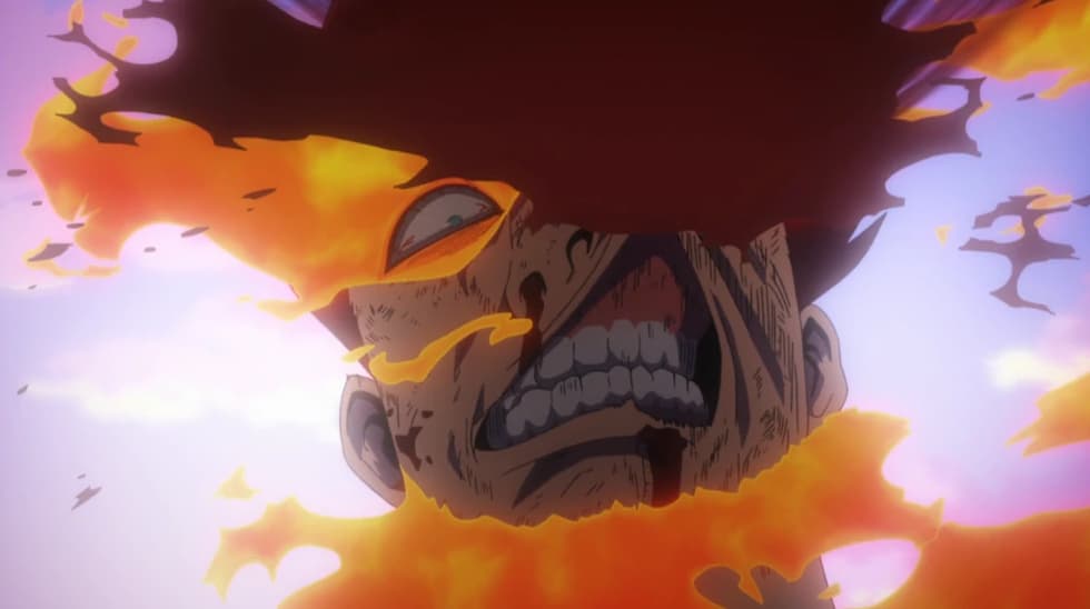 The 15 Worst Injuries In ‘My Hero Academia’