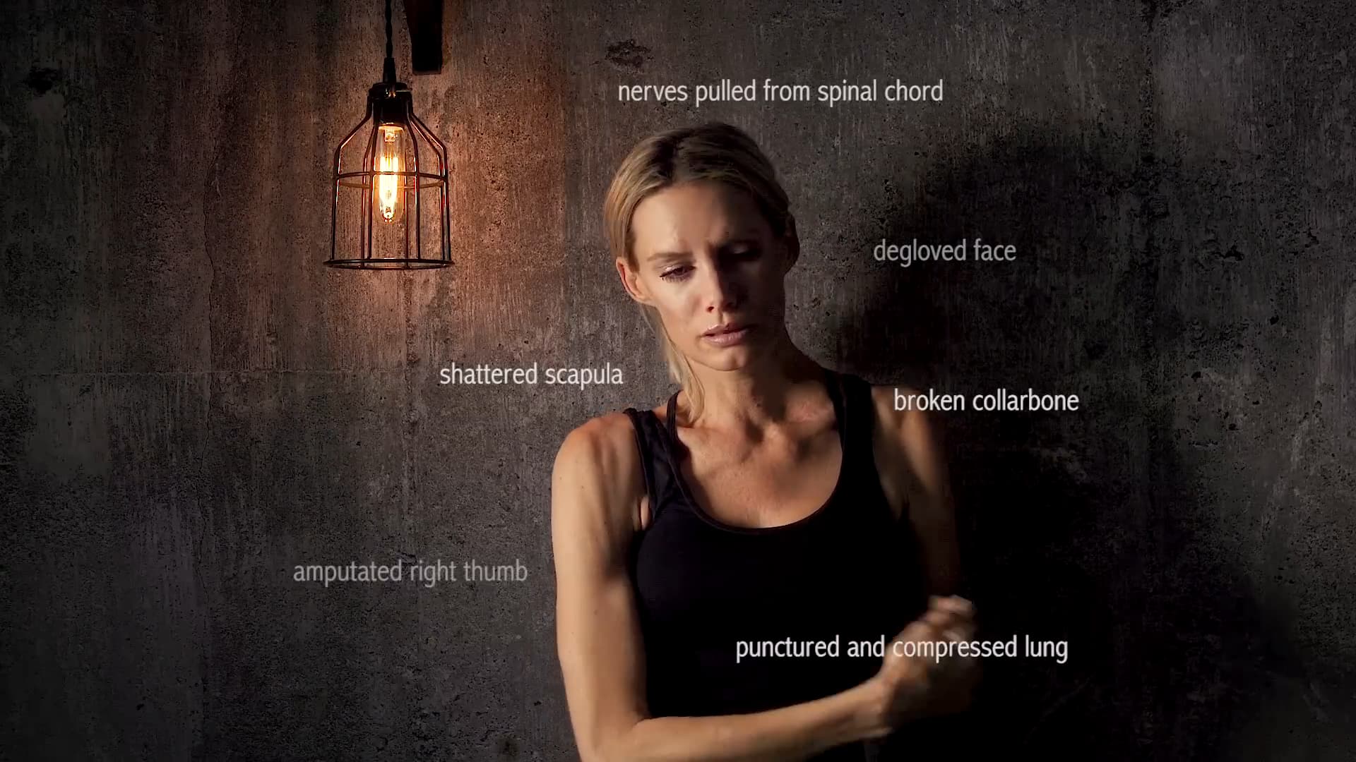 The 12 Worst Injuries Stunt Doubles Have Survived