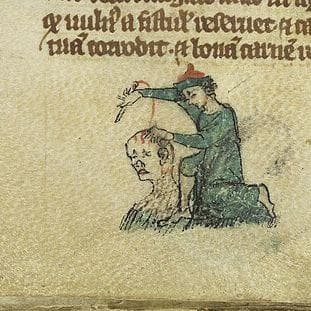 'The Extractor' Was A Painful Miracle Of Medieval Medicine That Saved A ...