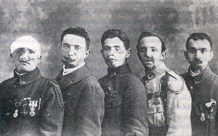 'The Banquet Of The Mutilated Faces' Tells The Story Of Facially ...