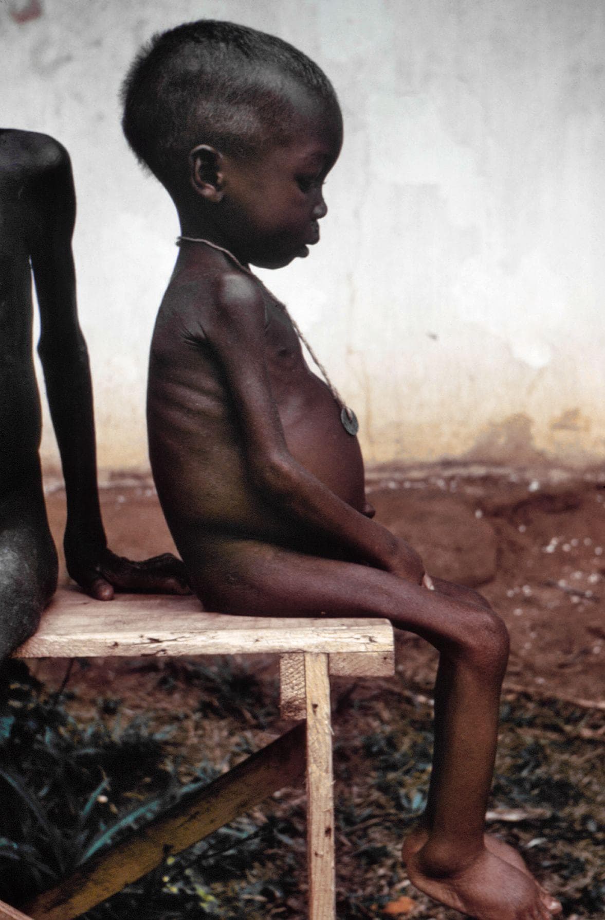 What Starvation Actually Does To Your Body