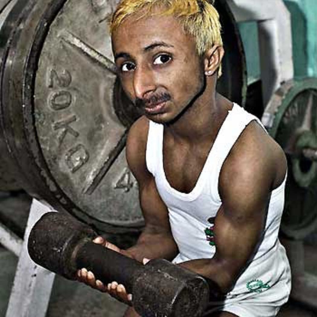 Famous People Who Died of Cerebral Aneurysm | List of Celebrity ...