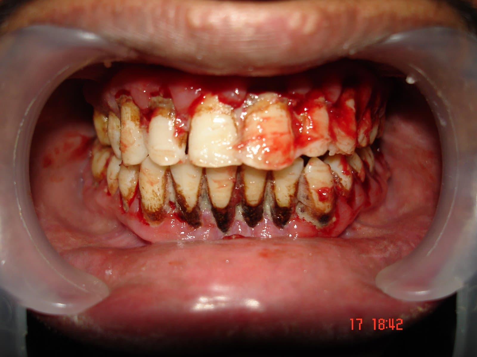 Grossest Things That Can Grow On Your Body | List Of Gross Diseases