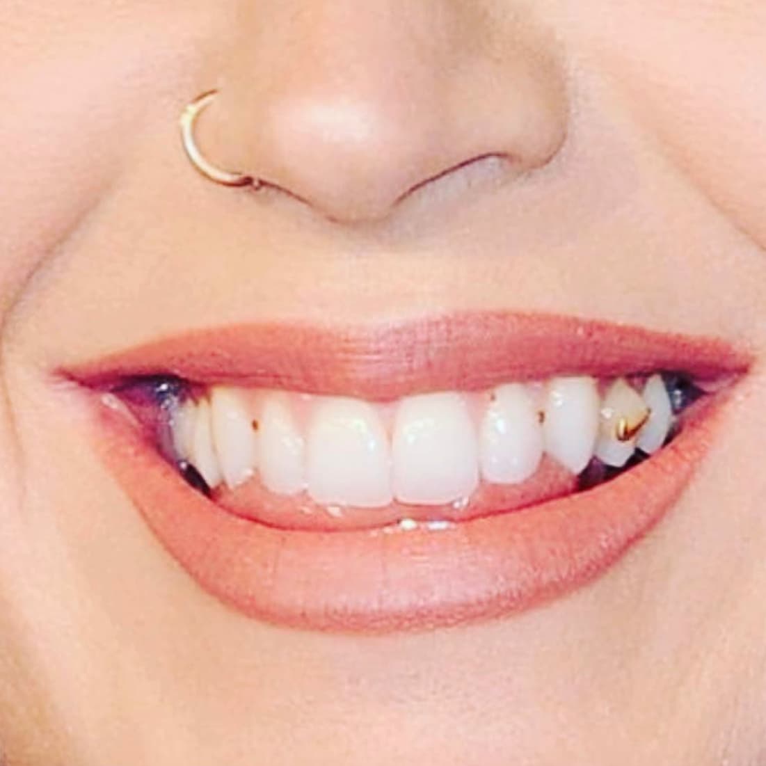 25+ Celebrities Who Dress Up Their Smiles With Tooth Gems