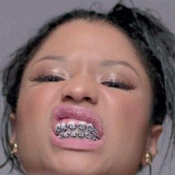 18 Rappers Who Wear Grills