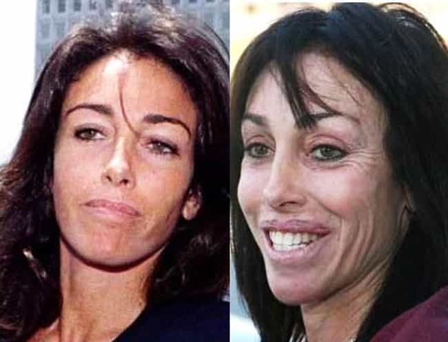 26 Celebs Who Lost Their Sex Appeal After Plastic Surgery Cool Dump