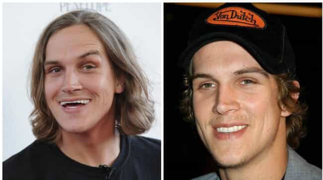 Jason Mewes Dentures The Untold Truth Of Jason Mewes Exclusive