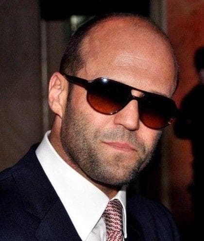 Bald Celebrities | Famous People with Hair Loss