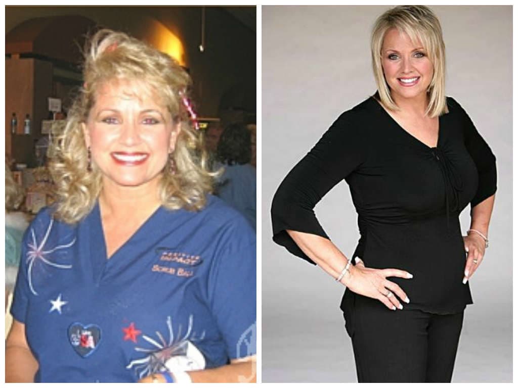 35+ Celebrities Who Had Weight Loss Surgery