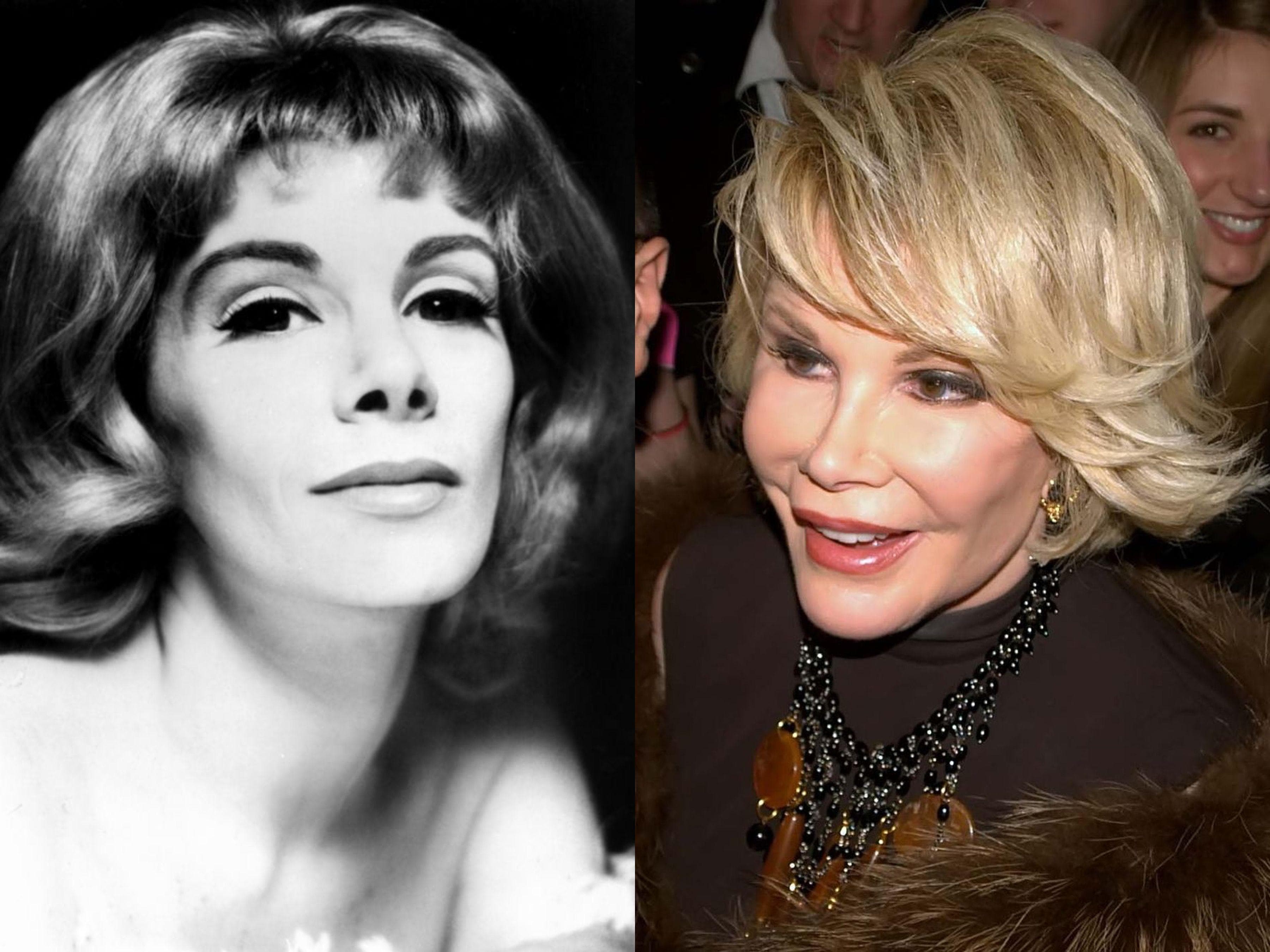 Celebrity Nose Jobs: Before and After