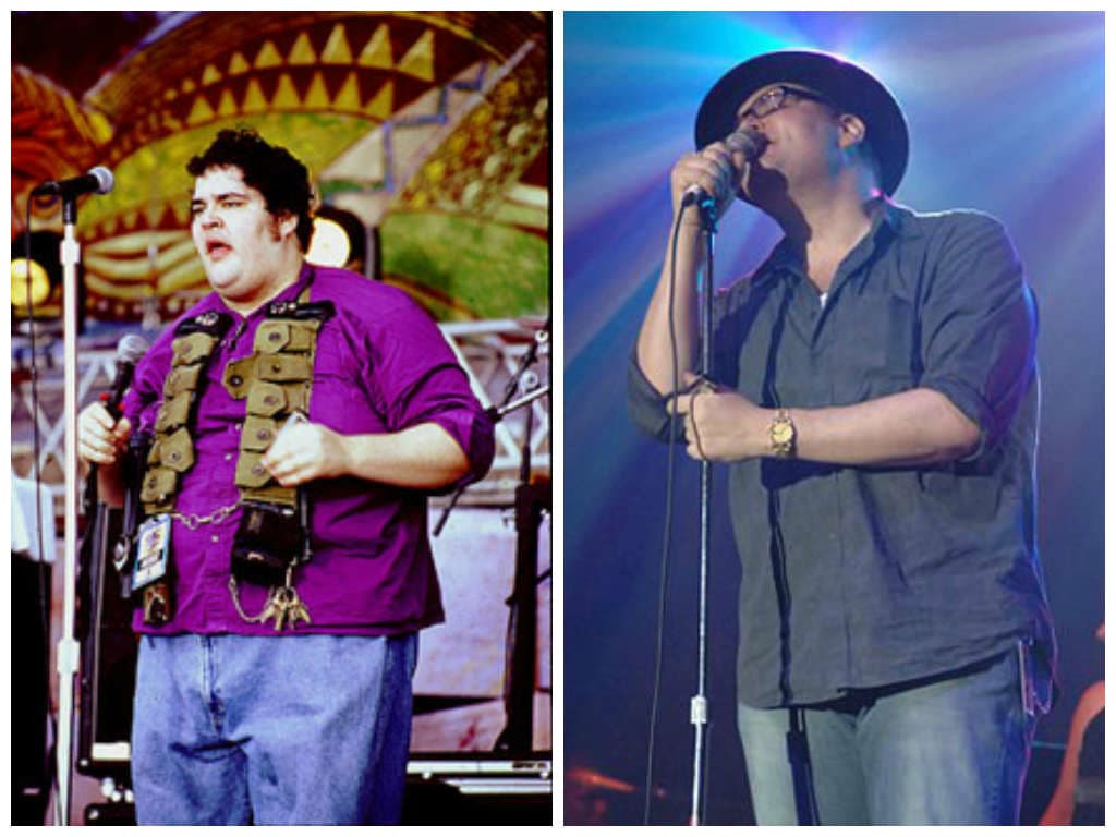 35+ Celebrities Who Had Weight Loss Surgery